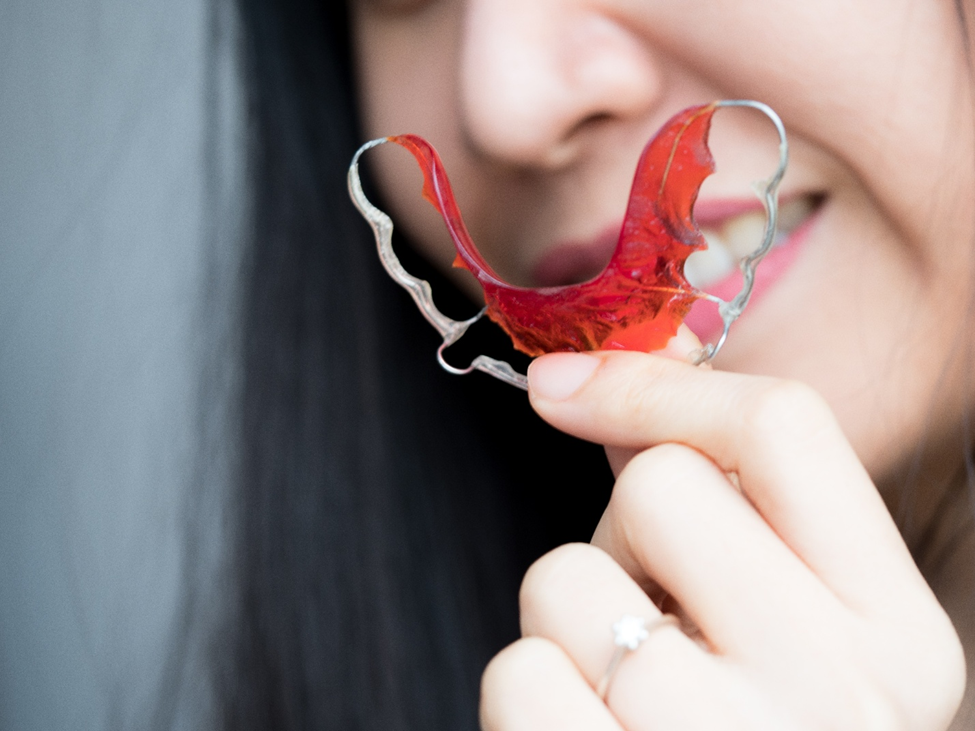 Tips for Caring for Your Retainer | Simply Orthodontics Worcester